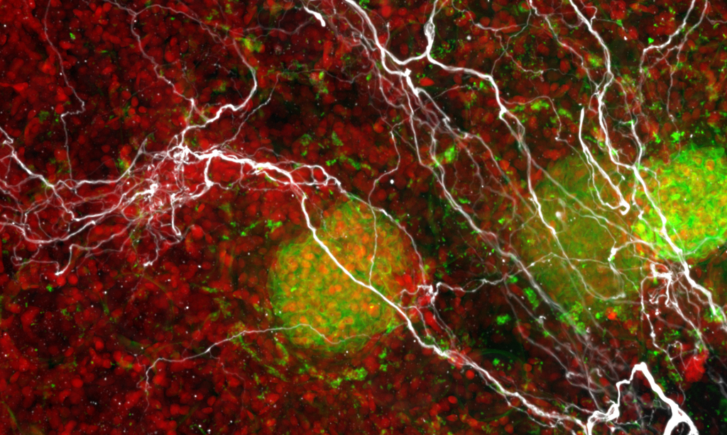White Paper: Laser Light Engine Output Stability | Lumencor