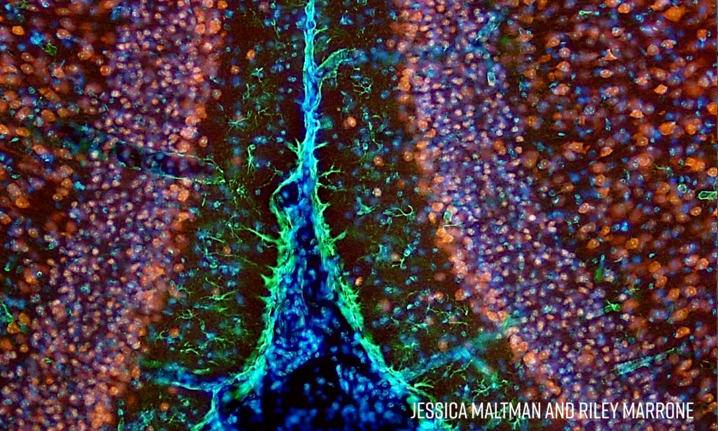 Lumencor Light Engines for Microscopy at VT’s Neuroscience Centers