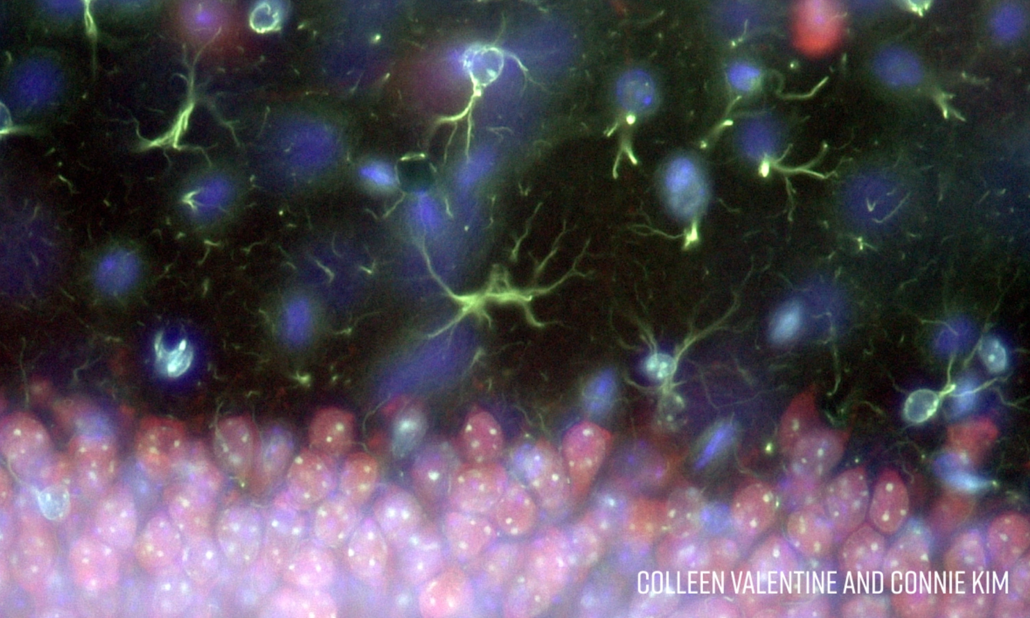 Lumencor Light Engines for Microscopy at VT’s Neuroscience Centers