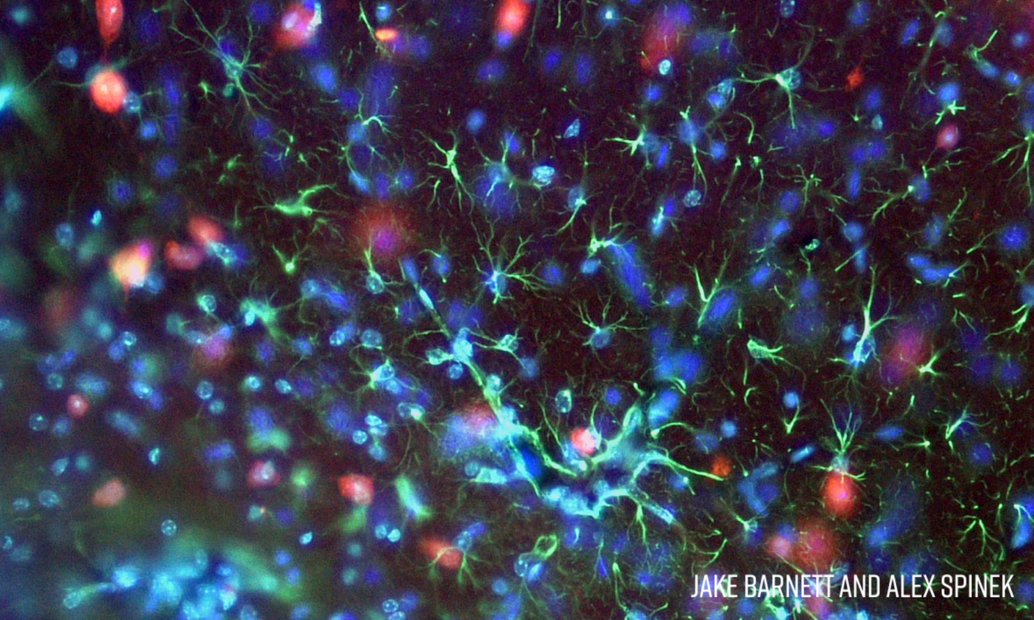 Lumencor Light Engines for Microscopy at VT’s Neuroscience Centers