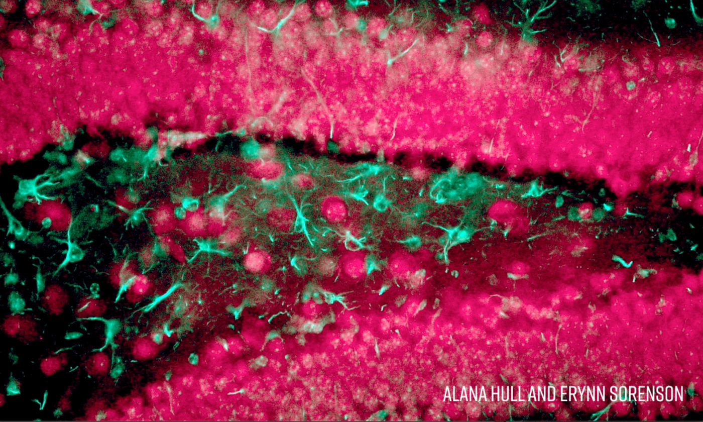 Lumencor Light Engines for Microscopy at VT’s Neuroscience Centers ...