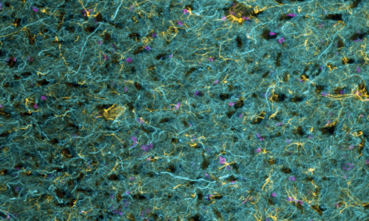 Advances in Laser Illumination for Spinning Disk Confocal Microscopy ...