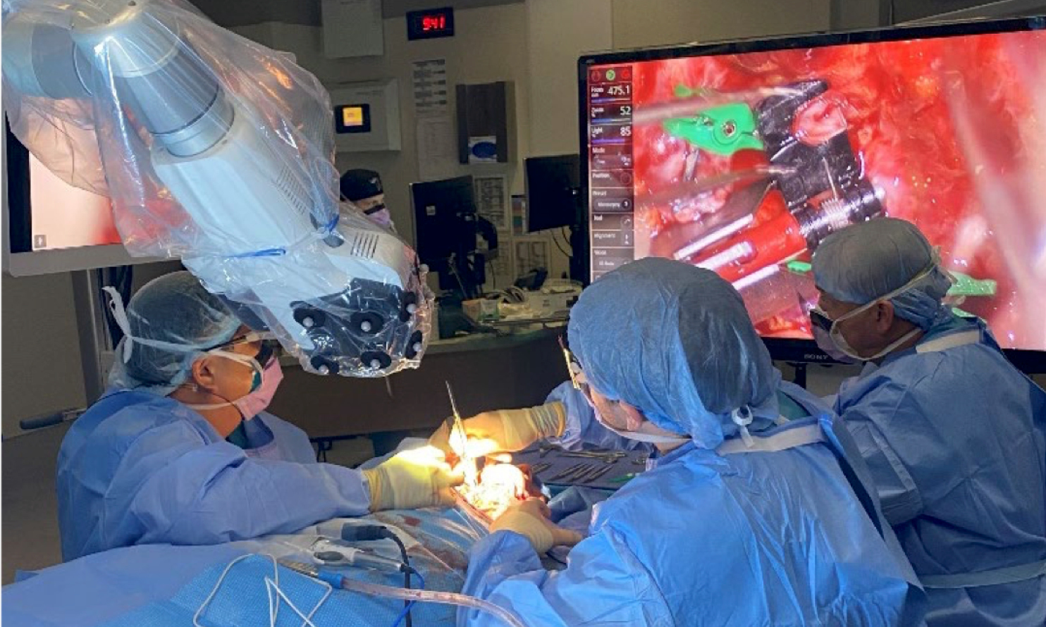 Solid-State Illumination for Intraoperative Imaging with the SPECTRA X ...