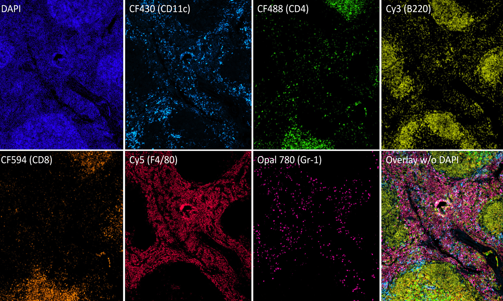 Multiplexed Fluorescence Detection with the new SPECTRA X Light Engine | Lumencor