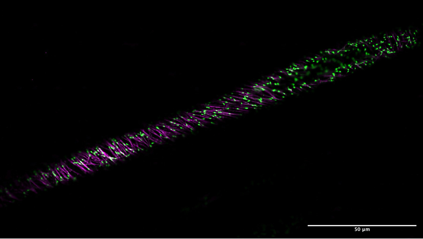 Lumencor’s ZIVA Light Engine for Yokogawa CSU-W1 featured at MBL’s ...