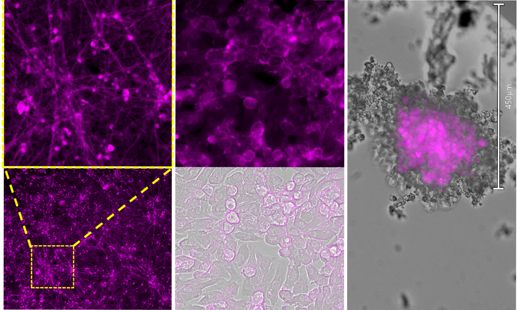 Bursting with Benefits: Optophysiology with BeRST Voltage Sensitive Dye