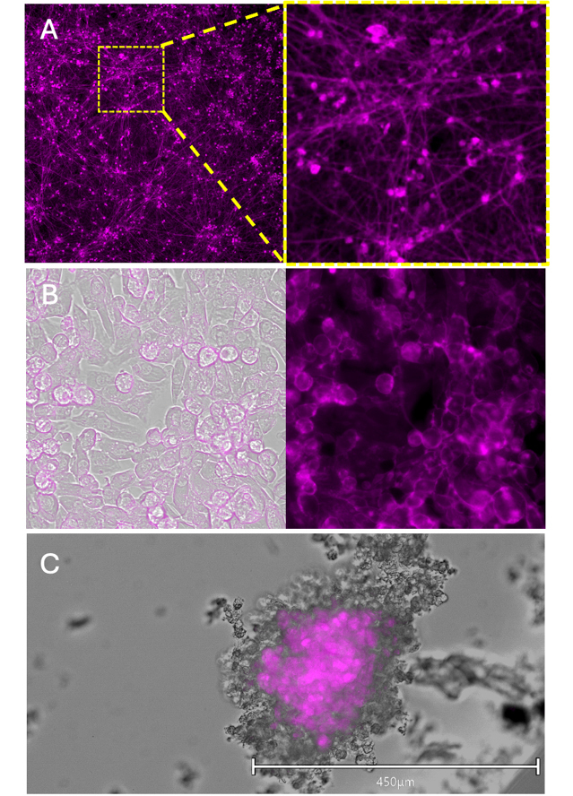 Bursting with Benefits: Optophysiology with BeRST Voltage Sensitive Dye