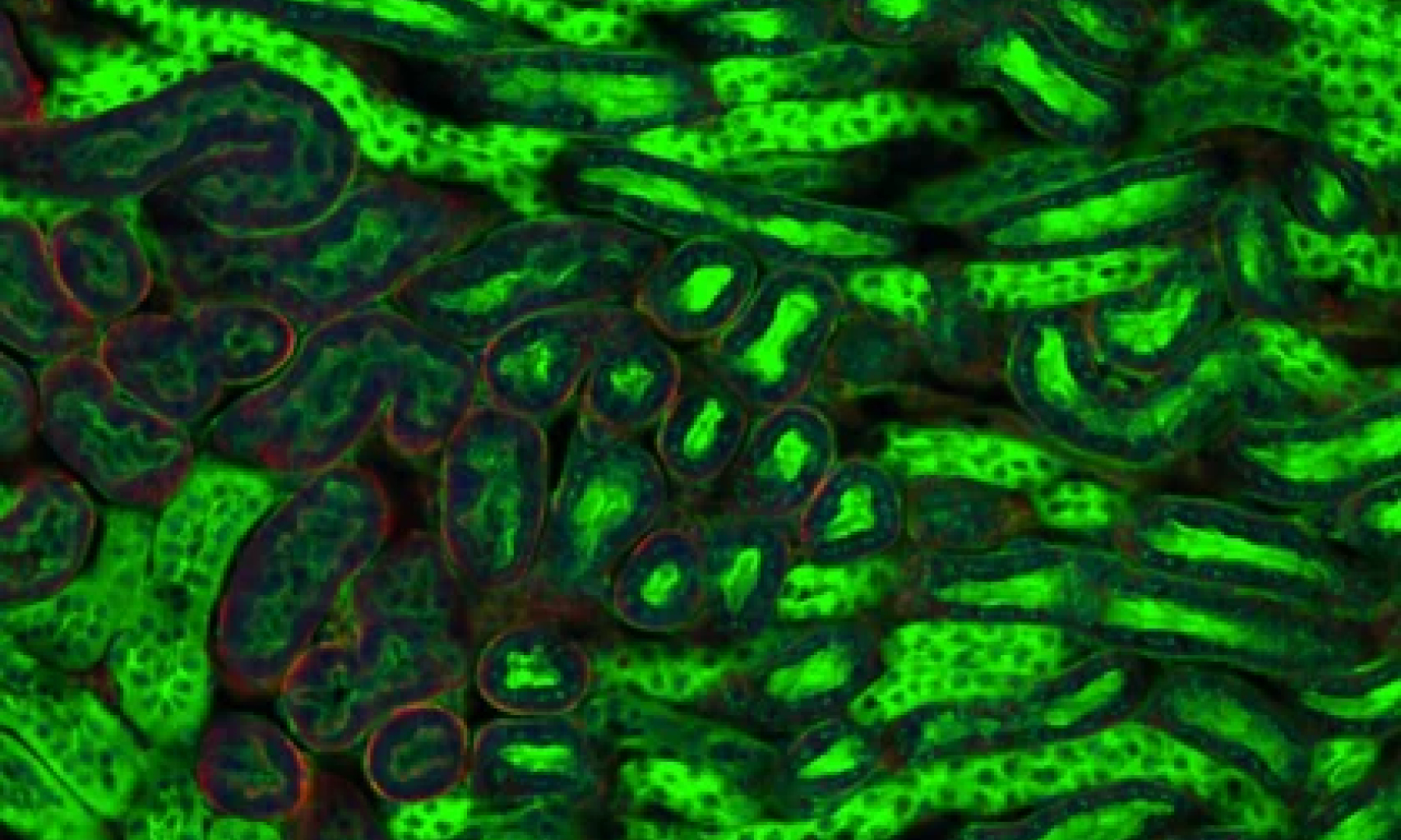 Confocal Imaging Workshop Series: Featuring the ZIVA Light Engine ...