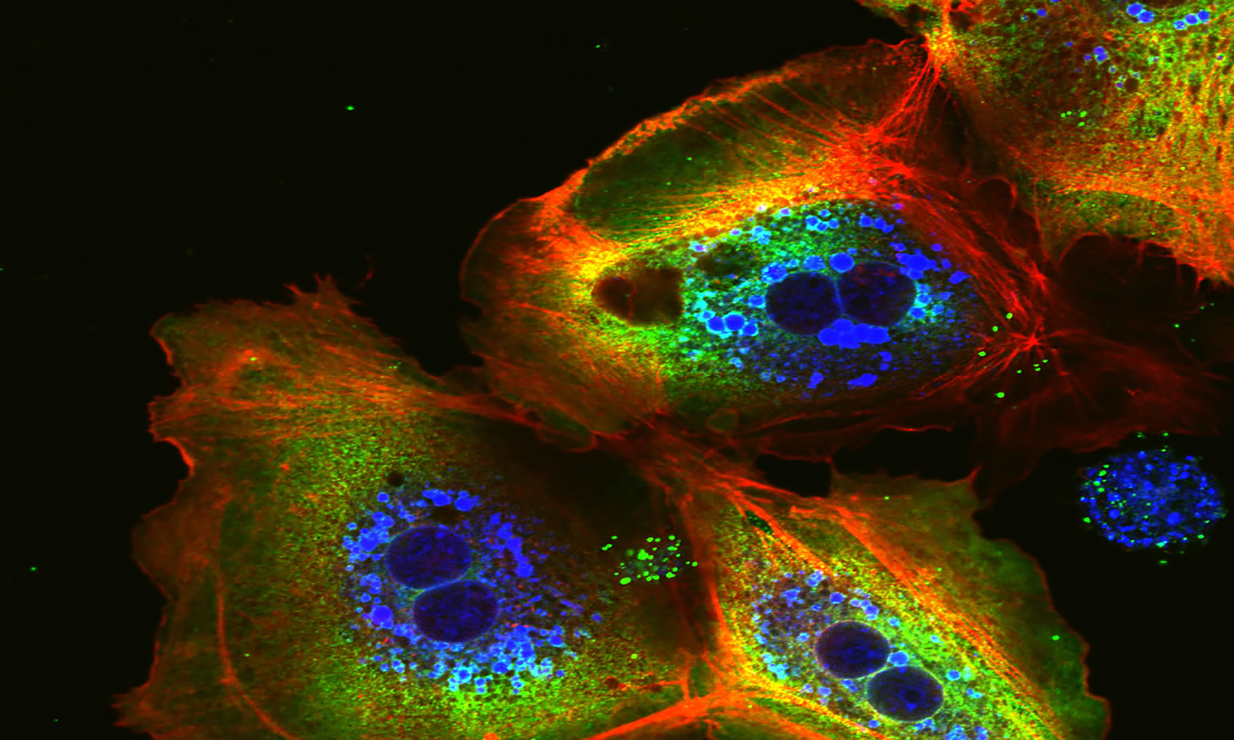 Powerful Solid-State Microscope Lights | The Lumencor Difference