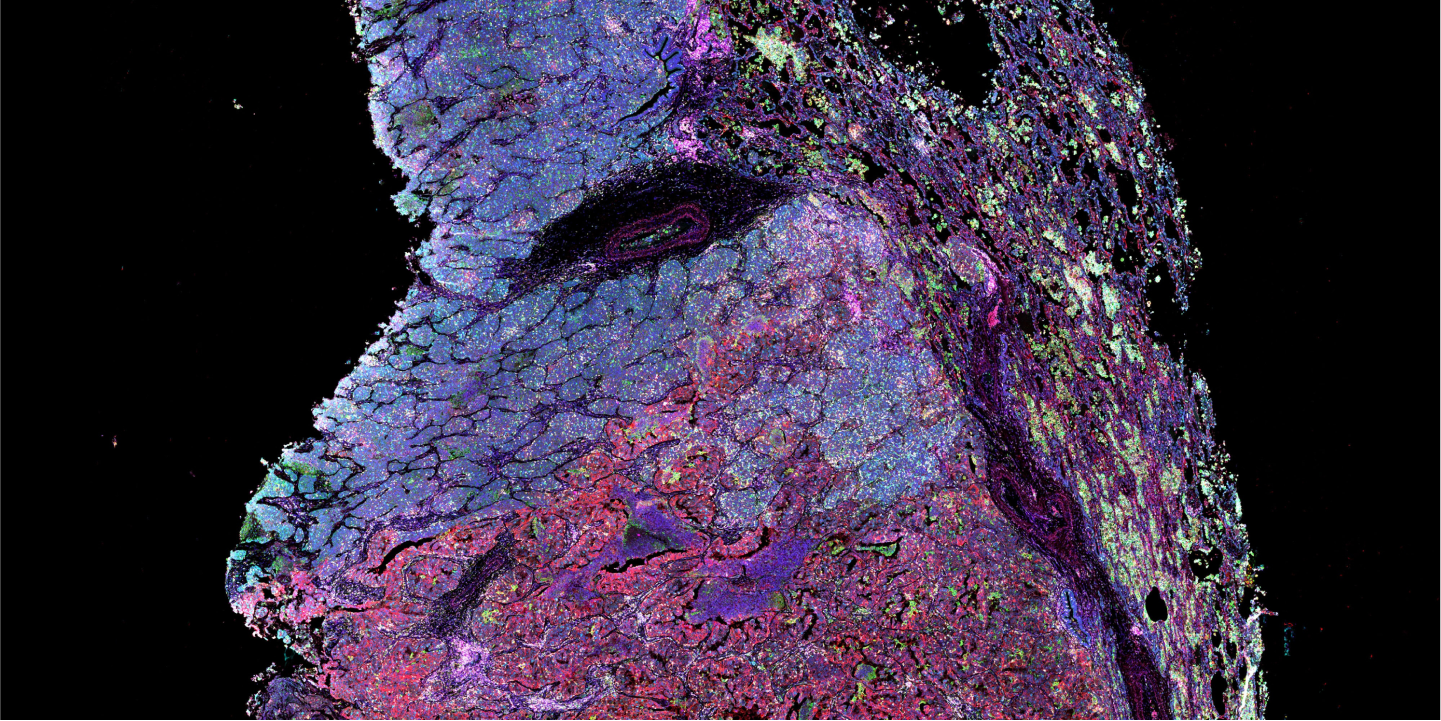 Lumencor | Solid-State Light Sources for Microscopy & More