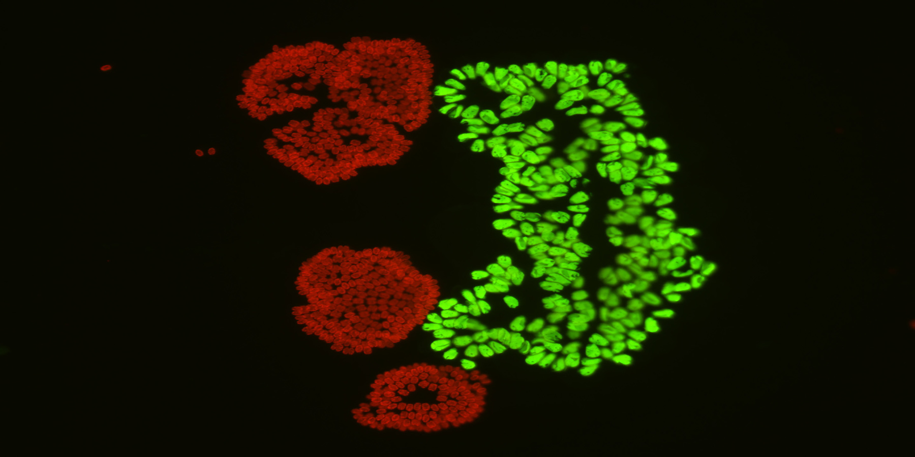 Lumencor | High-Performance, Solid-State Microscope Lighting