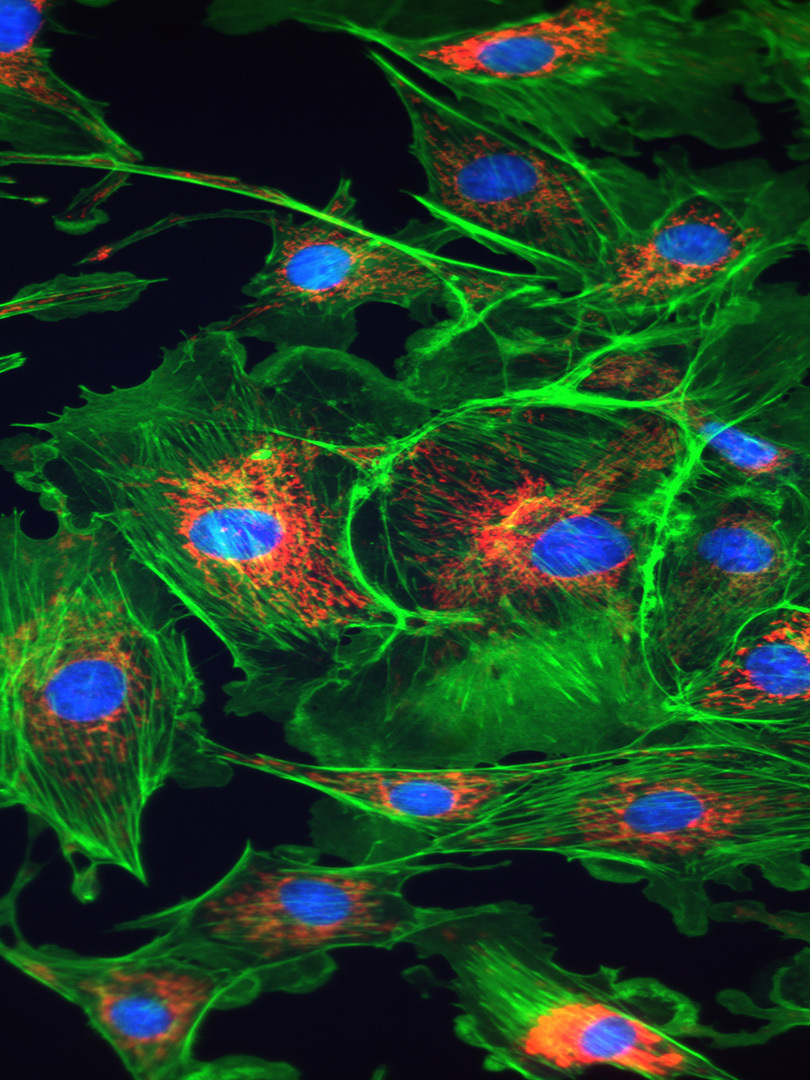 Lumencor | Solid-State Light Sources for Microscopy & More