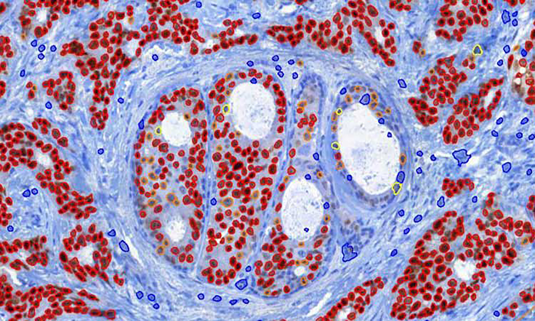 Histopathology | Lumencor Microscope Imaging Systems