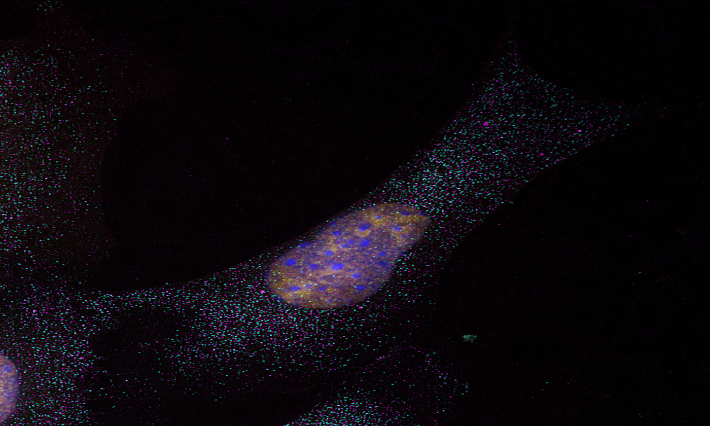 Cytogenetics | Fluorescence In Situ Hybridization (FISH) Light Source