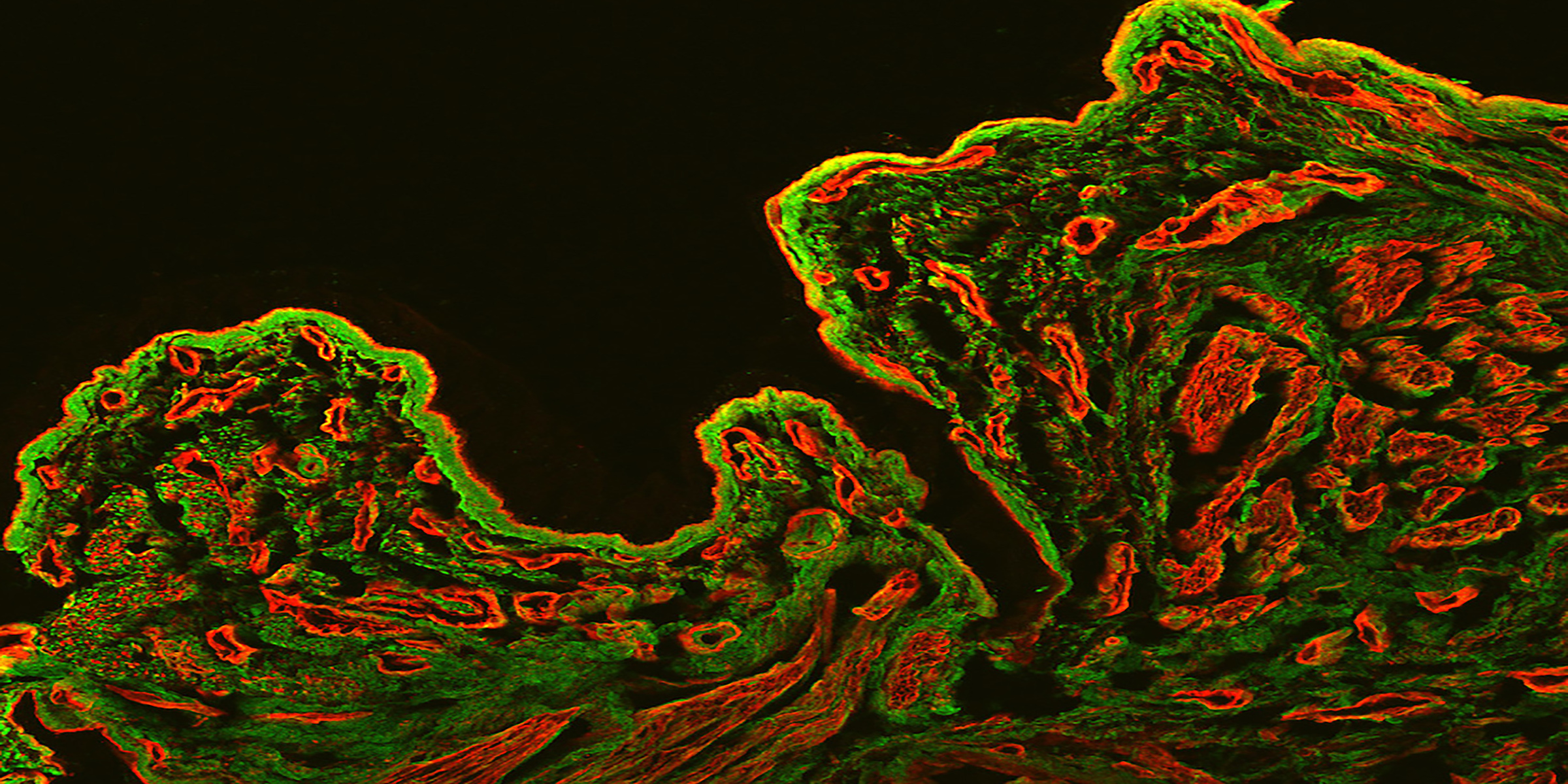 Lumencor | High-Performance, Solid-State Microscope Lighting