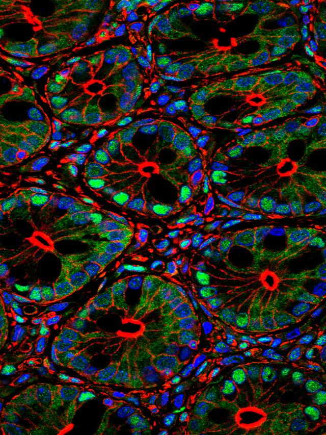 Lumencor | High-Performance, Solid-State Microscope Lighting