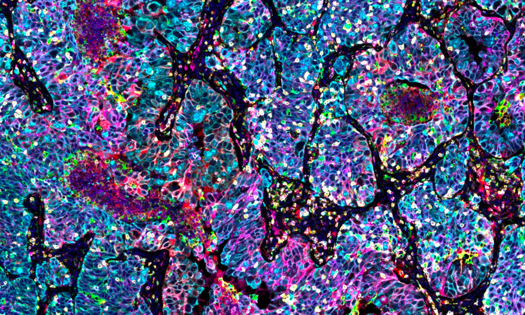 How Lumencor Optimizes Solid-State Illumination for Microscopy