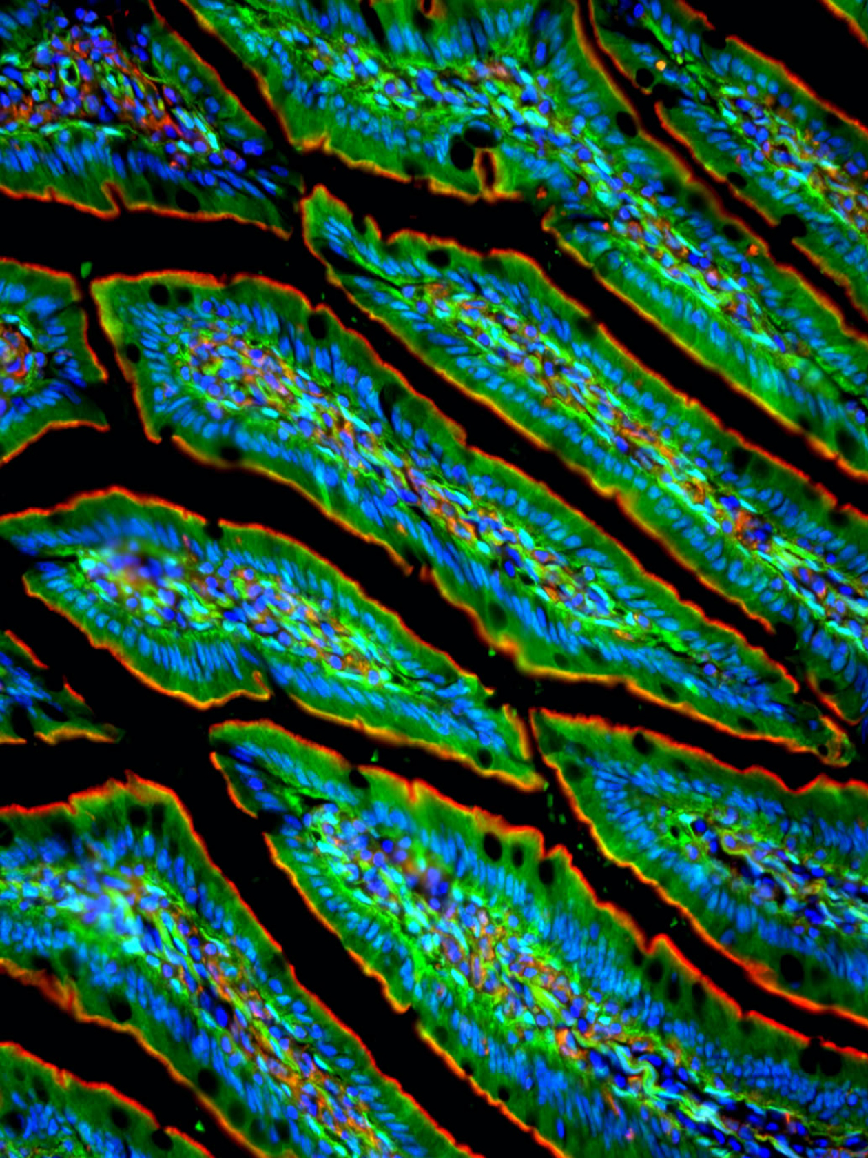 Lumencor | Solid-State Light Sources for Microscopy & More