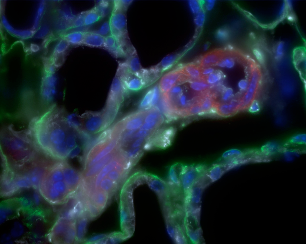 Advancing Bioanalysis with Solid-State Microscope Lighting