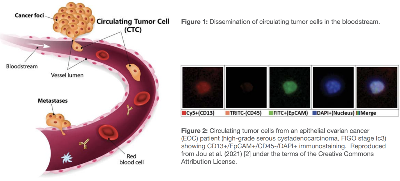 Detecting Cancer Cells with Immunofluorescence Illumination