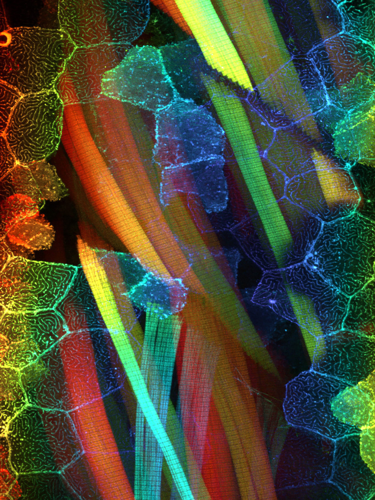 OEM Microscope Lighting | Solid State Illumination Systems