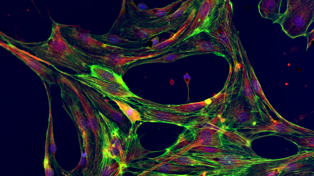Lumencor | High-Performance, Solid-State Microscope Lighting