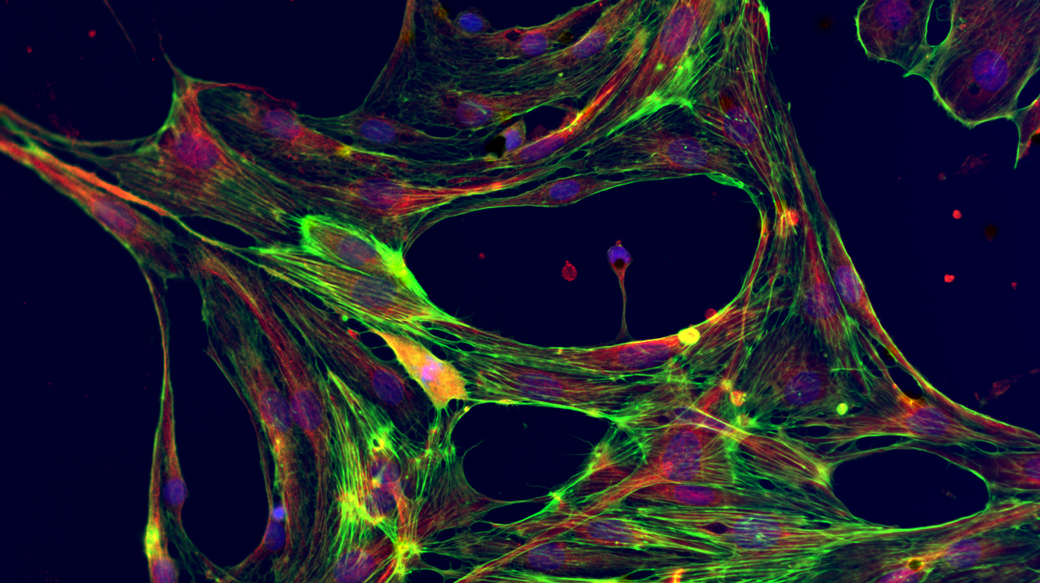 Lumencor | High-Performance, Solid-State Microscope Lighting