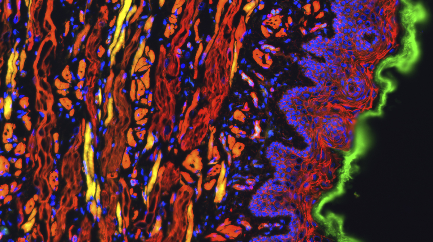 Dichroic Mirrors & Filters | Light Source for Fluorescence Microscopy