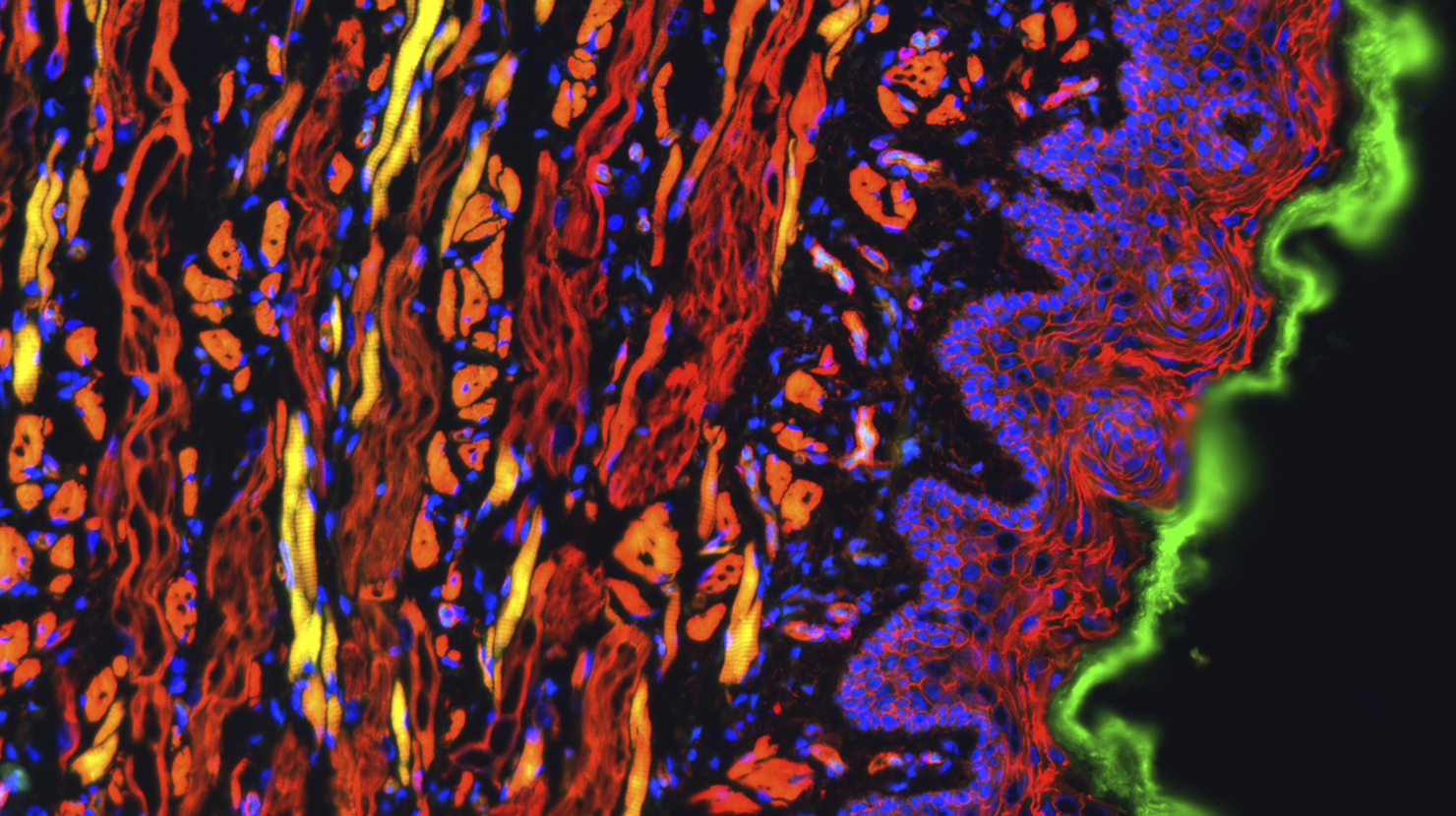 Lumencor | High-Performance, Solid-State Microscope Lighting