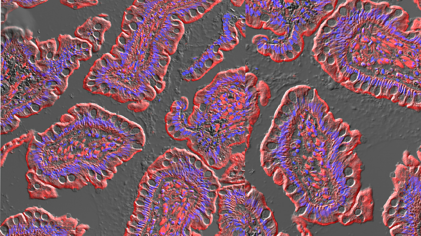 Lumencor | High-Performance, Solid-State Microscope Lighting