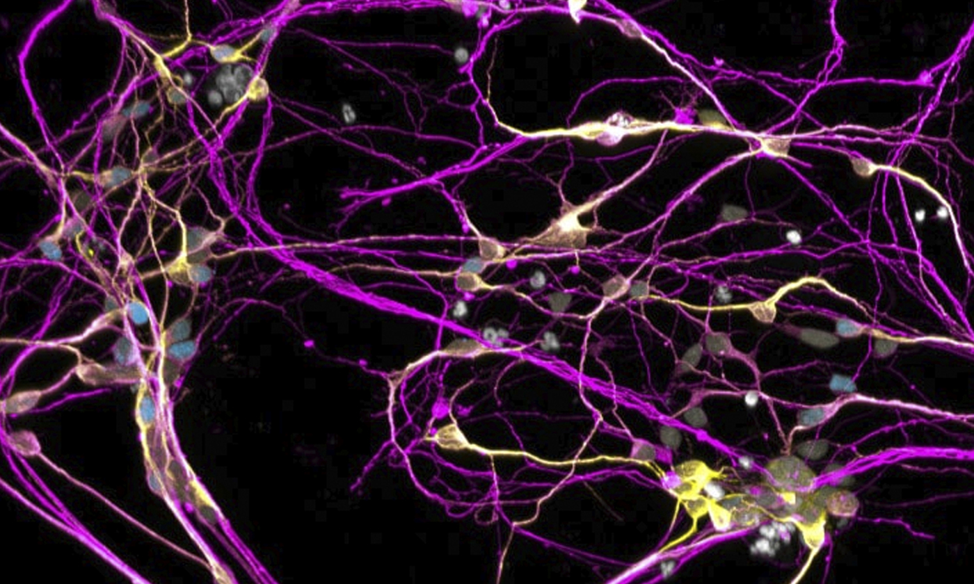 Power Regulation with Lumencor Fluorescence Microscope Light Engines ...