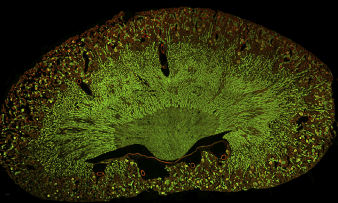 Confocal Microscopy Light Source: The CELESTA Light Engine | Lumencor