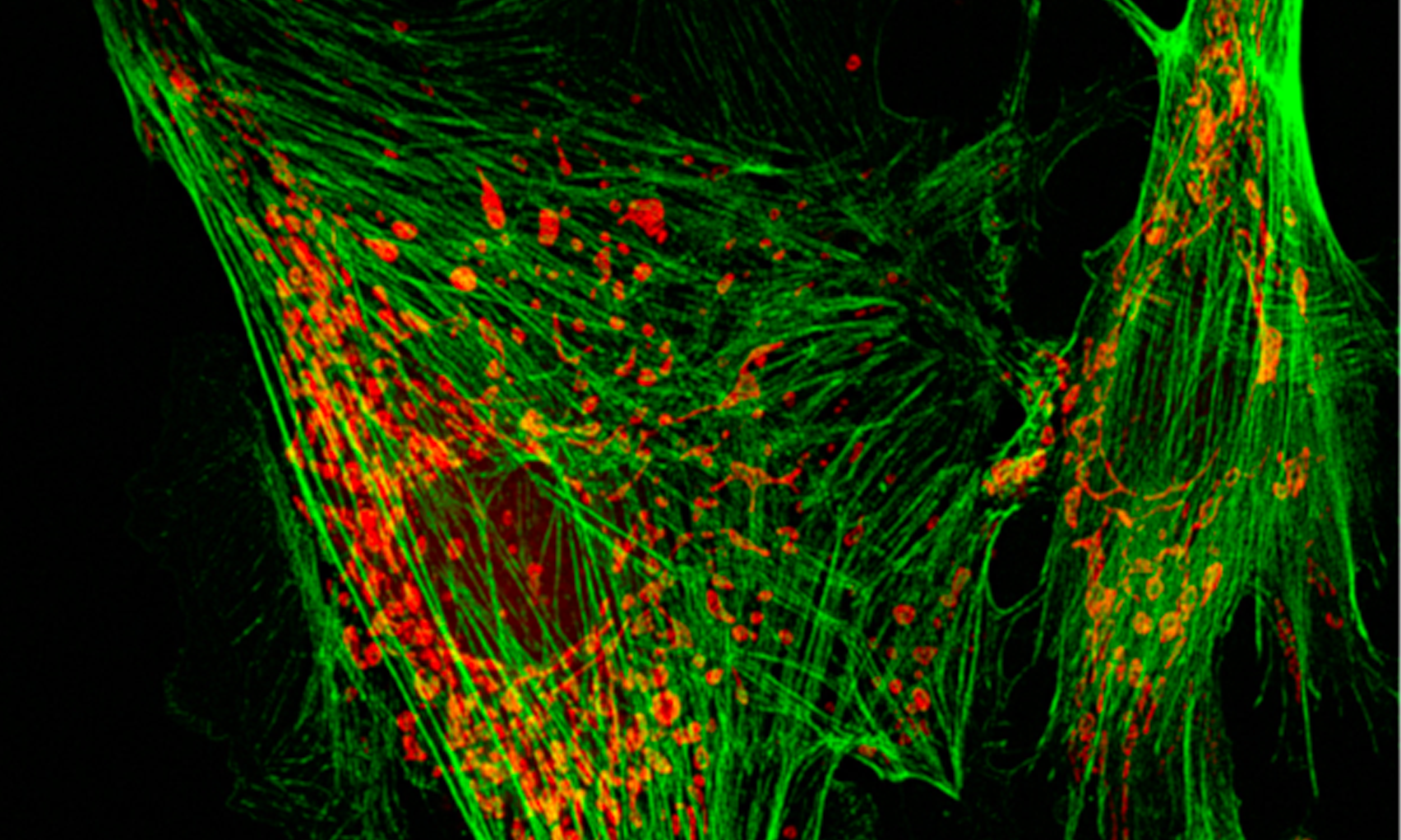 ZIVA v CELESTA Light Engine: Comparing Optical Fibers | Lumencor