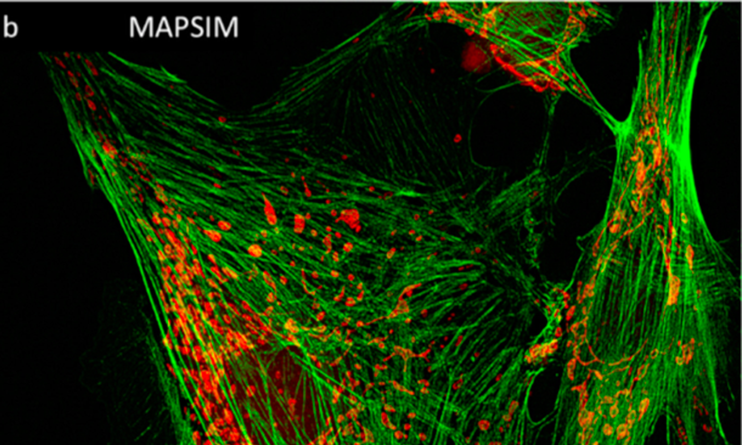 ZIVA v CELESTA Light Engine: Comparing Optical Fibers | Lumencor
