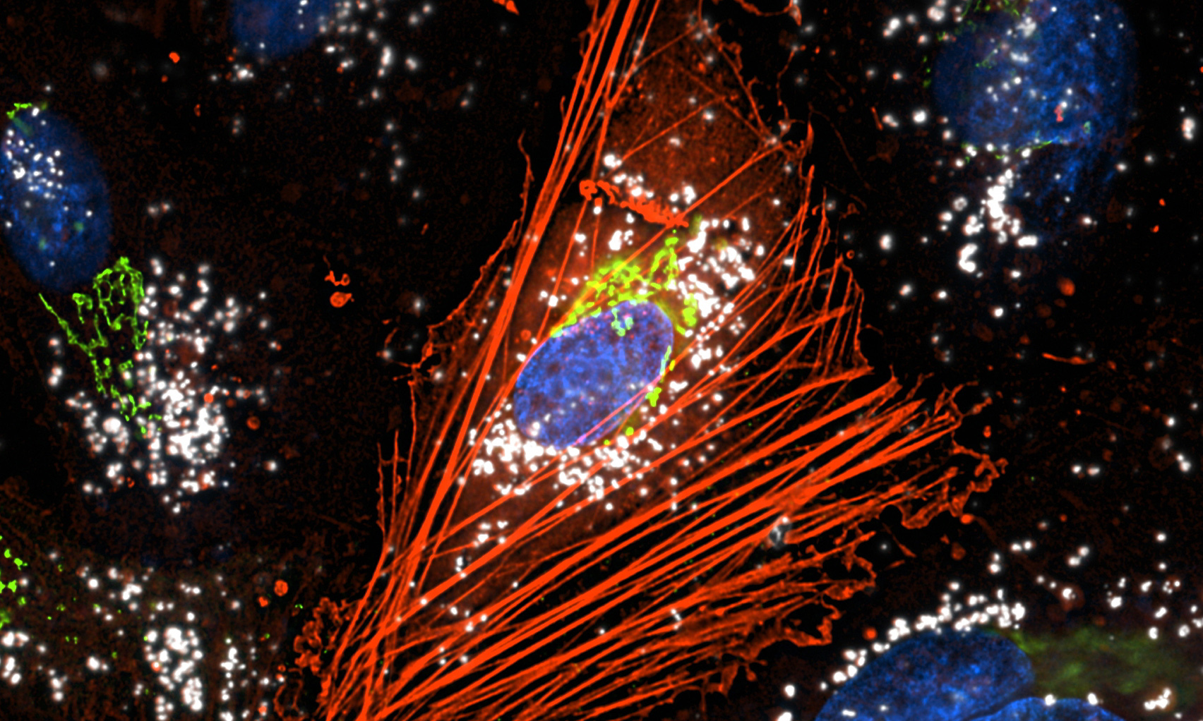 Winners: Earth Day Light Microscopy Imaging Competition | Lumencor