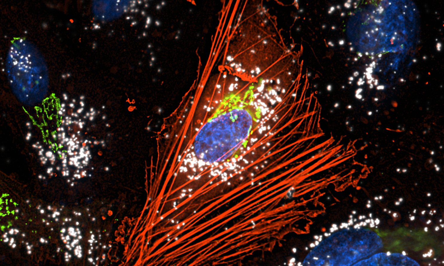 Winners: Earth Day Light Microscopy Imaging Competition | Lumencor