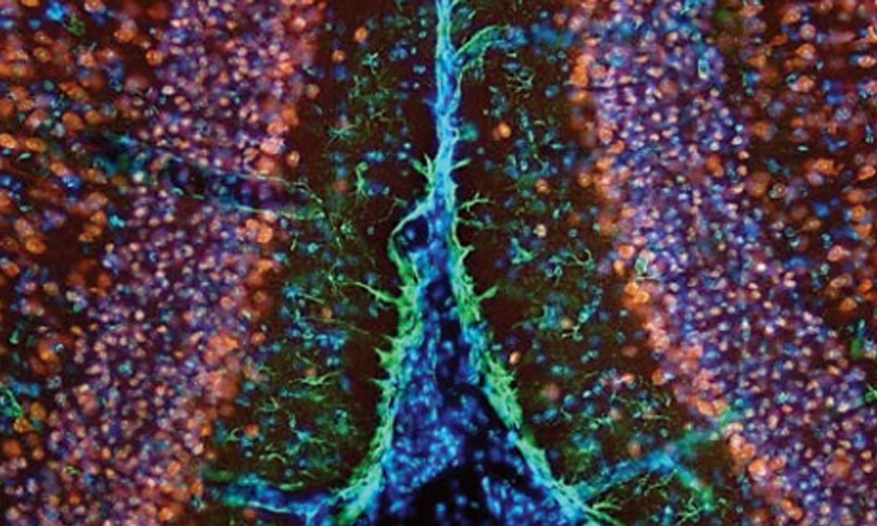 MIRA Light Engine for Microscopy at VT's Neuroscience School | Lumencor