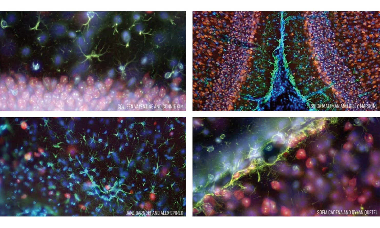 MIRA Light Engine for Microscopy at VT's Neuroscience School | Lumencor