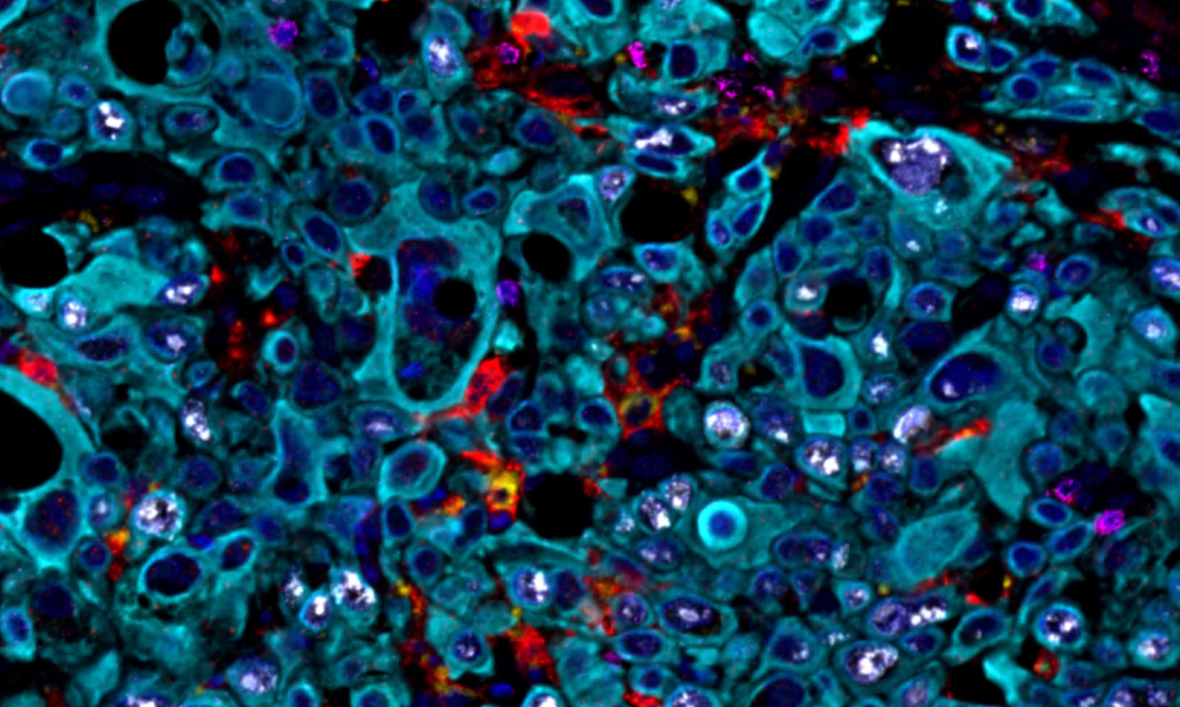 Fast, High-Throughput Imaging with SPECTRA Light Engines | Lumencor