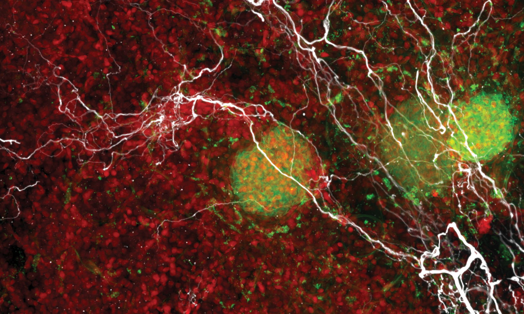 Lumencor Resources | Solid-State Illumination for Microscopy & More