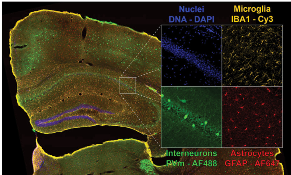 Case Study: 3D High-Content Imaging with the CELESTA Light Engine ...