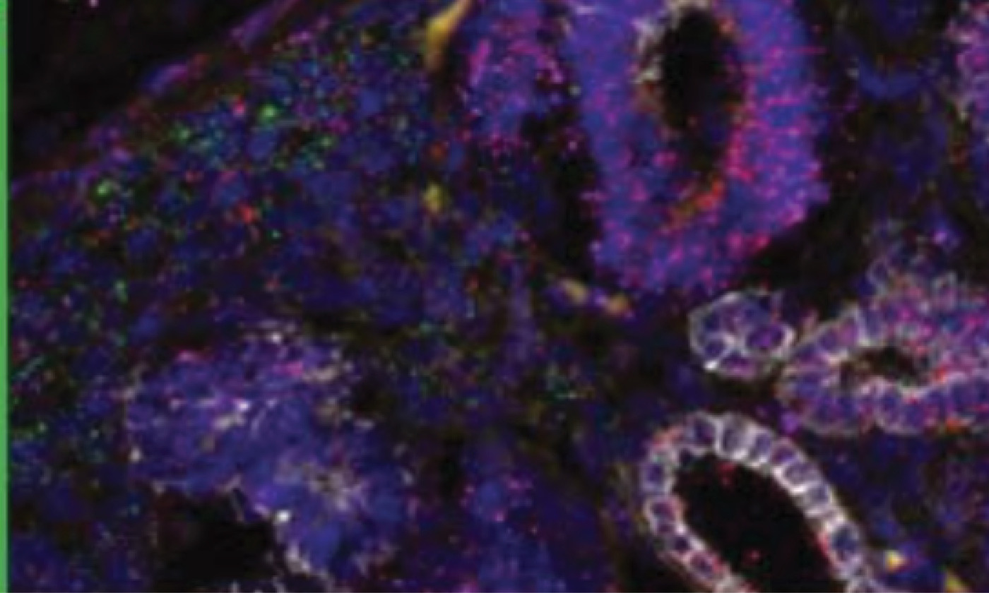 Six-Color Imaging with the SPECTRA X Light Engine | Lumencor