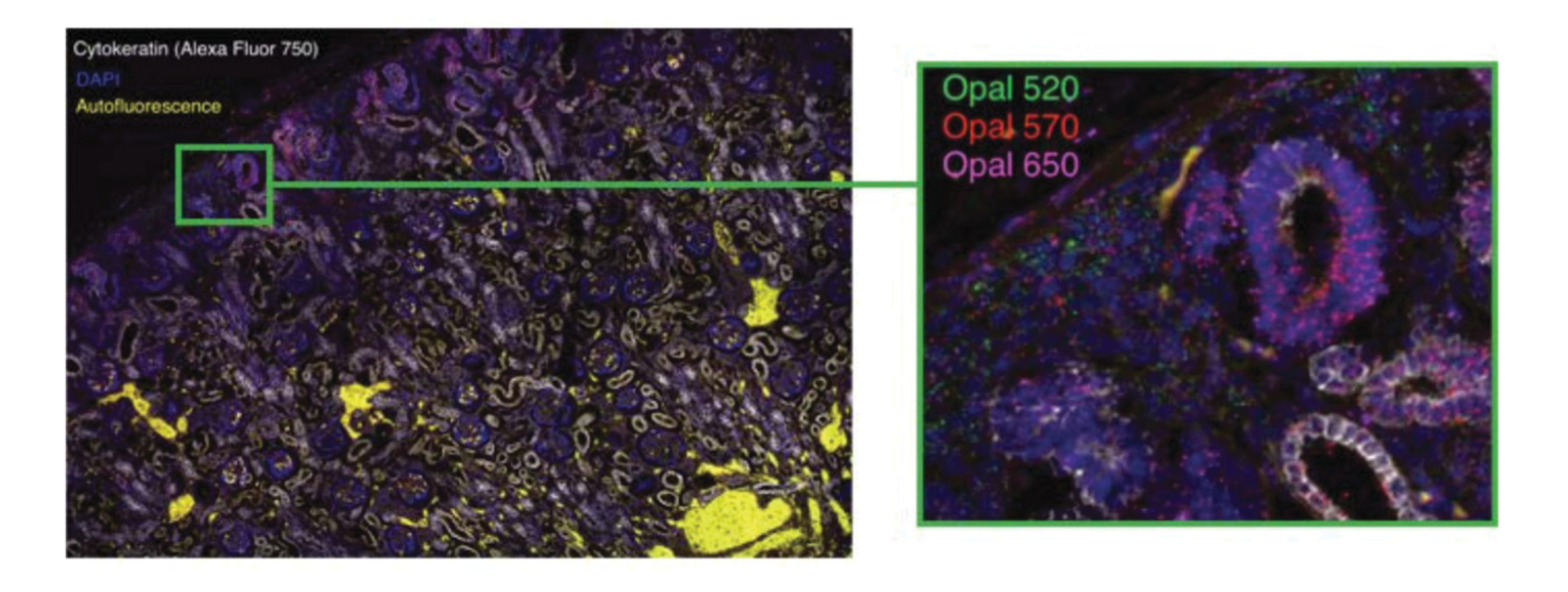 Six-Color Imaging with the SPECTRA X Light Engine | Lumencor