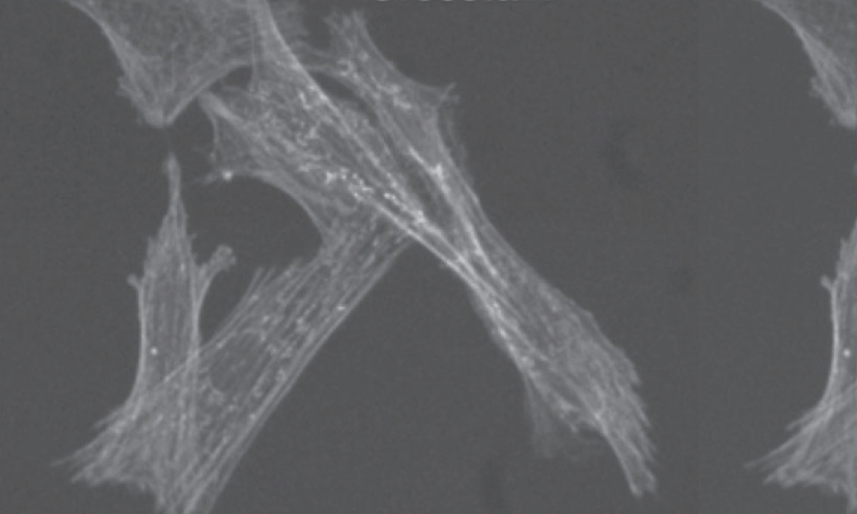 Bleedthrough or crosstalk? | Lumencor