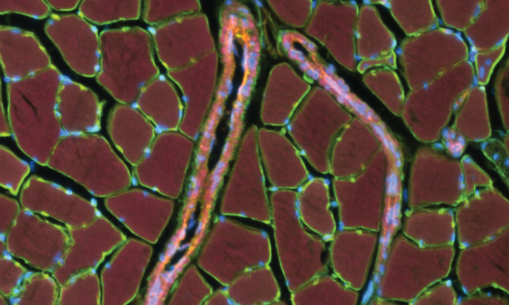 Lumencor Resources | Solid-State Illumination for Microscopy & More