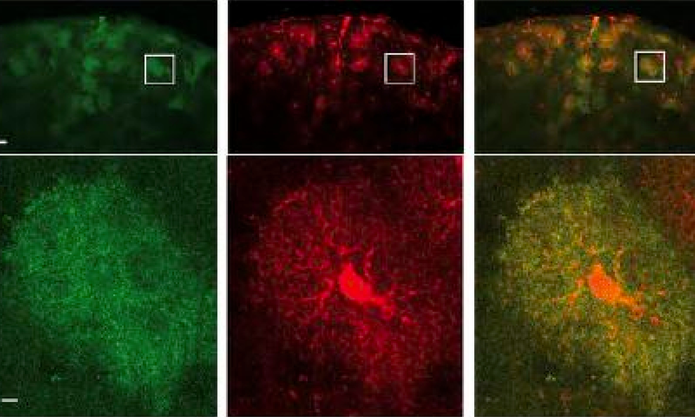 AURA Light Engine for Ca2+ Ratio Imaging | Lumencor
